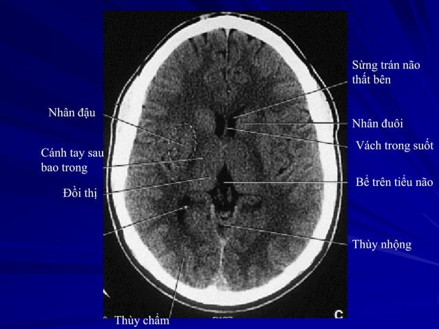 Huong dan doc ctscan so nao | PDF