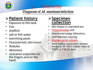 Mycobacterium marinum | PPTX