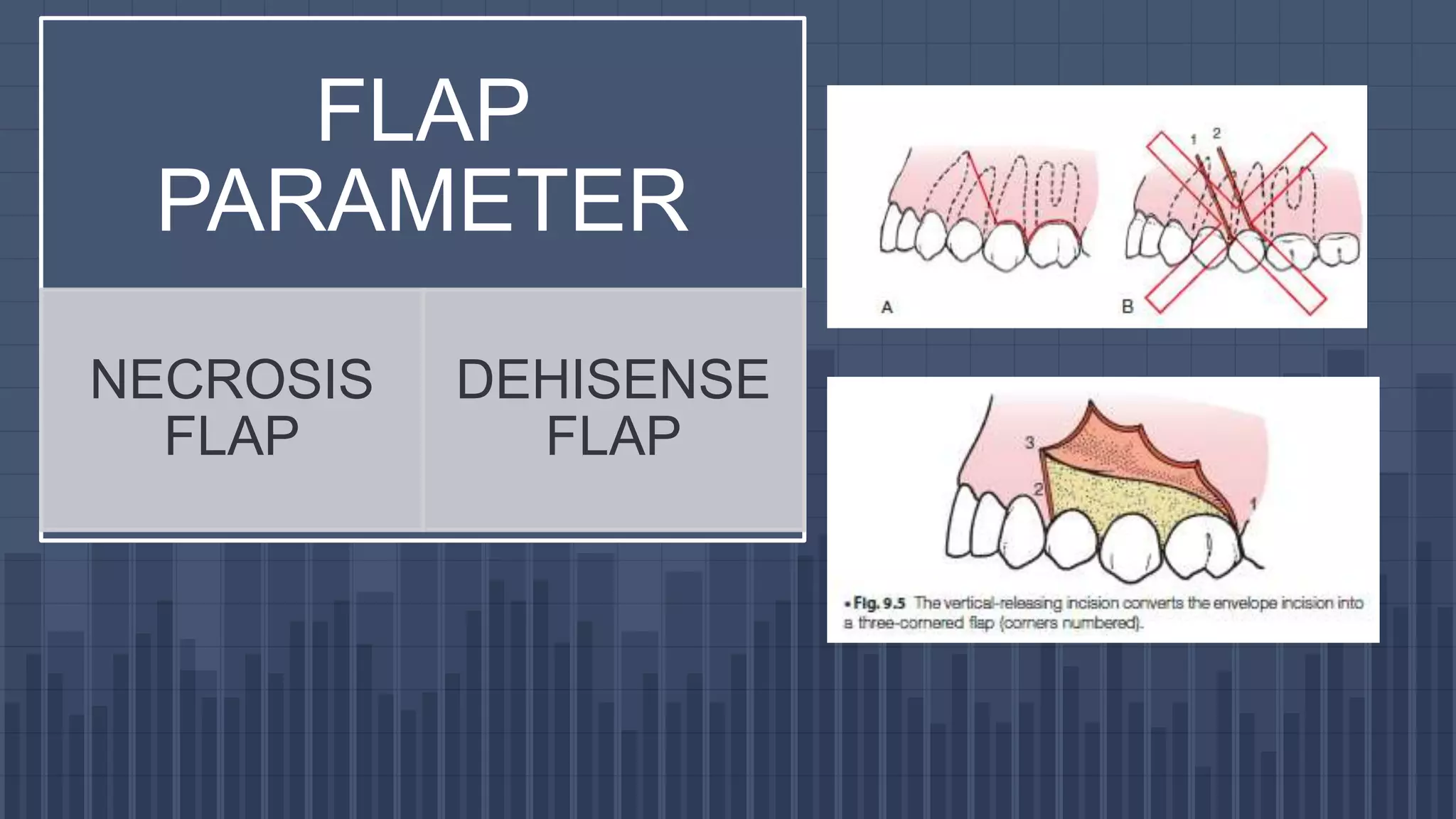 HUPP PRINCIPLES OF FLAP DESIGN, DEVELOPMENT AND MANAGEMENT - MUHAMMAD ...