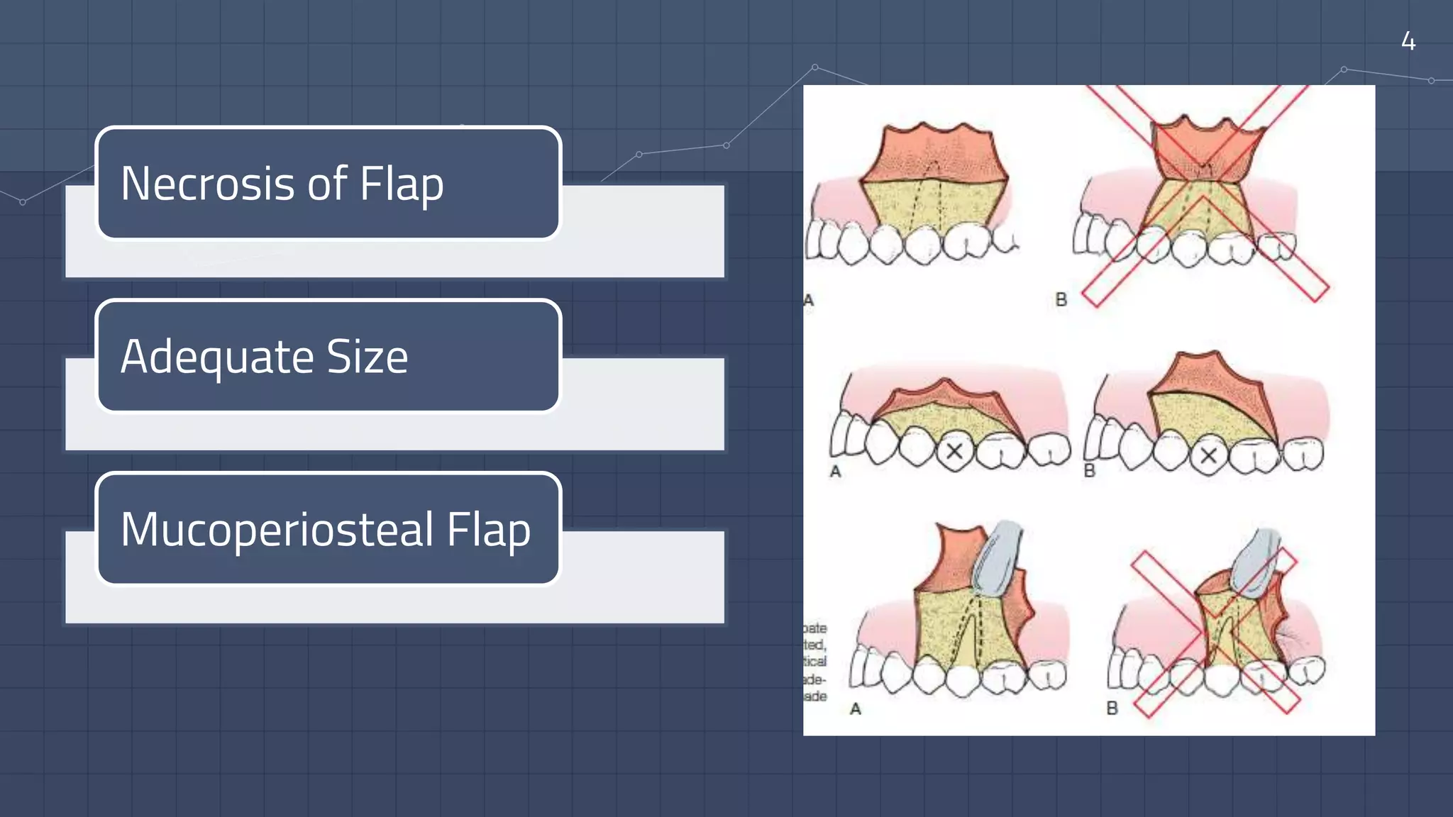 HUPP PRINCIPLES OF FLAP DESIGN, DEVELOPMENT AND MANAGEMENT - MUHAMMAD ...