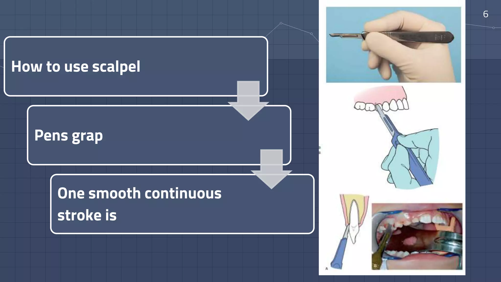 HUPP PRINCIPLES OF FLAP DESIGN, DEVELOPMENT AND MANAGEMENT - MUHAMMAD ...