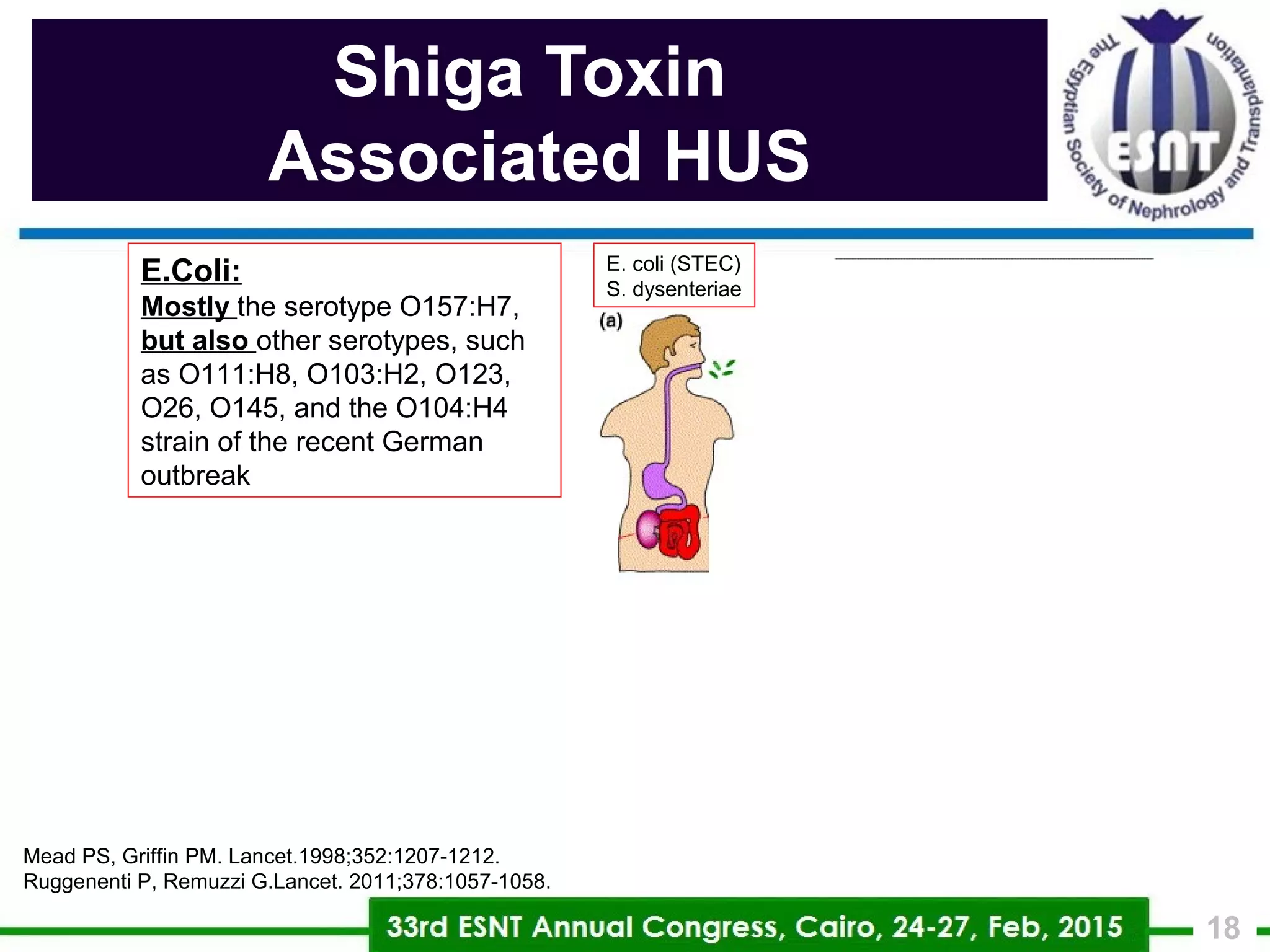 Hemolytic Uremic Syndrome Induced AKI (From Pathogenesis to Bedside ...