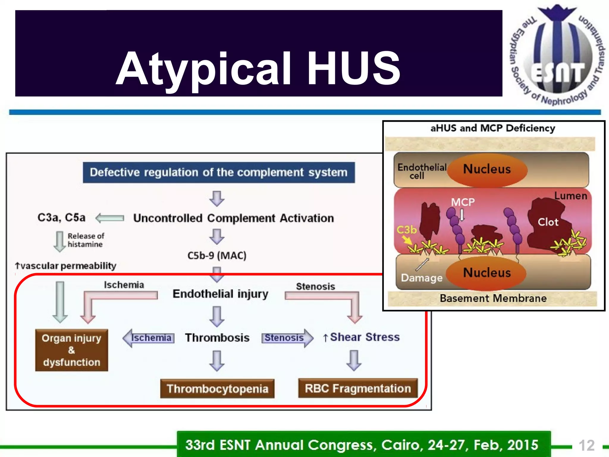 Hemolytic Uremic Syndrome Induced AKI (From Pathogenesis to Bedside ...