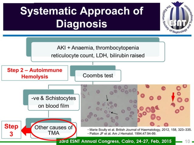 Hemolytic Uremic Syndrome Induced AKI (From Pathogenesis to Bedside ...