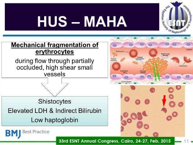 Hemolytic Uremic Syndrome Pathophysiology