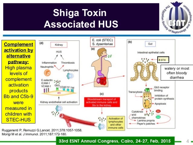 Hemolytic Uremic Syndrome Induced AKI (From Pathogenesis to Bedside)