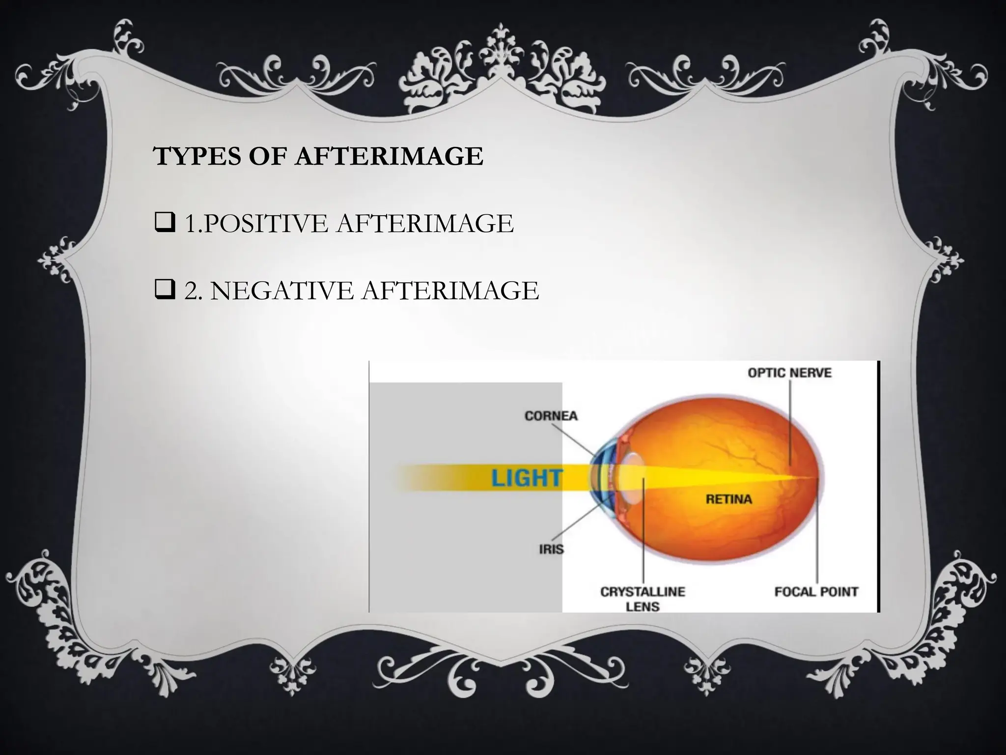 why we use to understand brightness and image | PPT