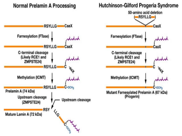 Hutchinson-Gilford Progeria Syndrome | PPSX | Genetics | Science