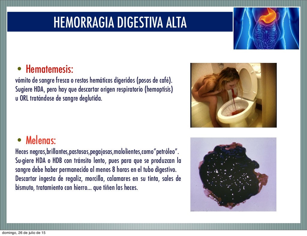 Hemorragia Digestiva Sintomas Causas E Tratamento Tua