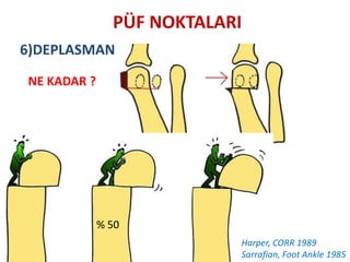 Hv distal osteotomi edit_hHALLUKS VALGUS - DİSTAL OSTEOTOMİLER | PPTX