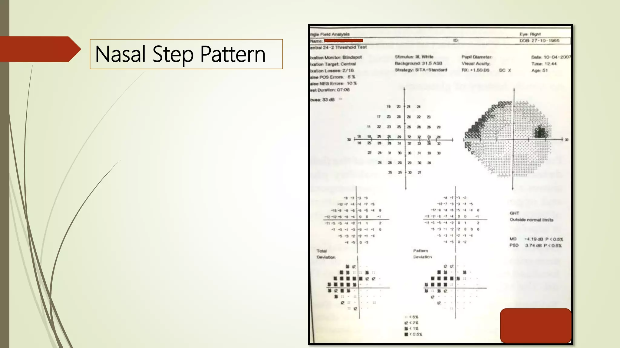 Perimetry & Humprey visual field assay (HVFA) | PPTX