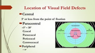 Hvfa humphrey visual field | PPTX