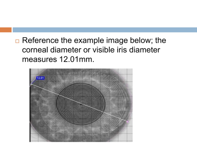 Hvid | PPTX | Eye and Vision Conditions | Diseases and Conditions