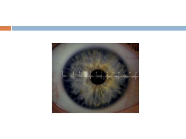 Hvid | PPTX | Eye and Vision Conditions | Diseases and Conditions