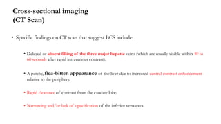 HEPATIC VENOUS OUTFLOW TRACT OBSTRUCTION/BUD-CHAIRI SYNDROME (BCS/HVOTO ...