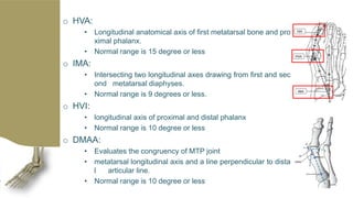 Outcome of Mitchell's procedure in the treatment of hallux valgus | PPT