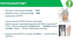 Outcome of Mitchell's procedure in the treatment of hallux valgus | PPT