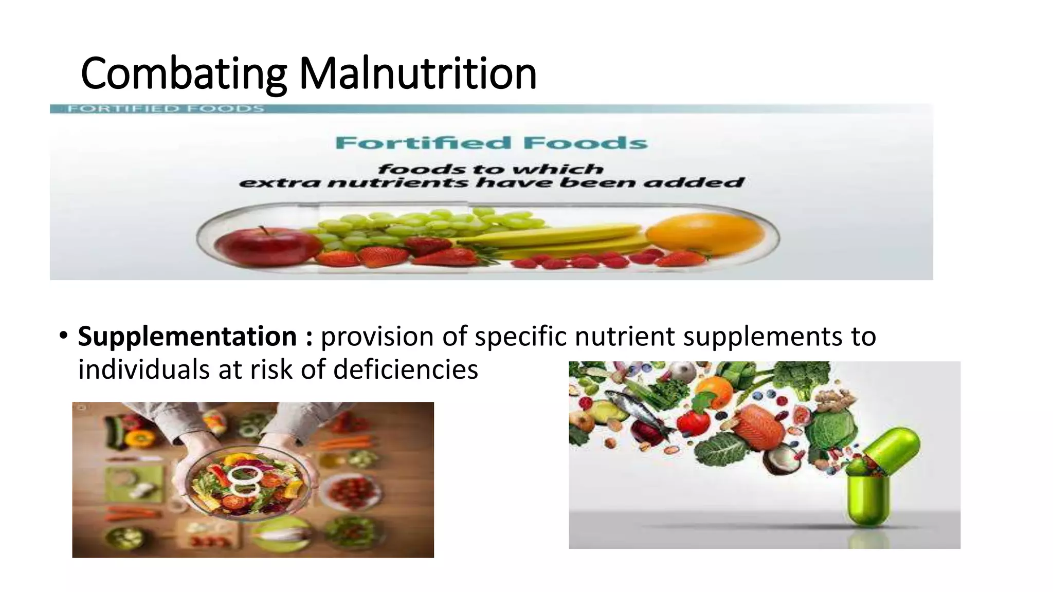 Malnutrition.pptx