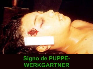 Hx de arma de fuego.ppt