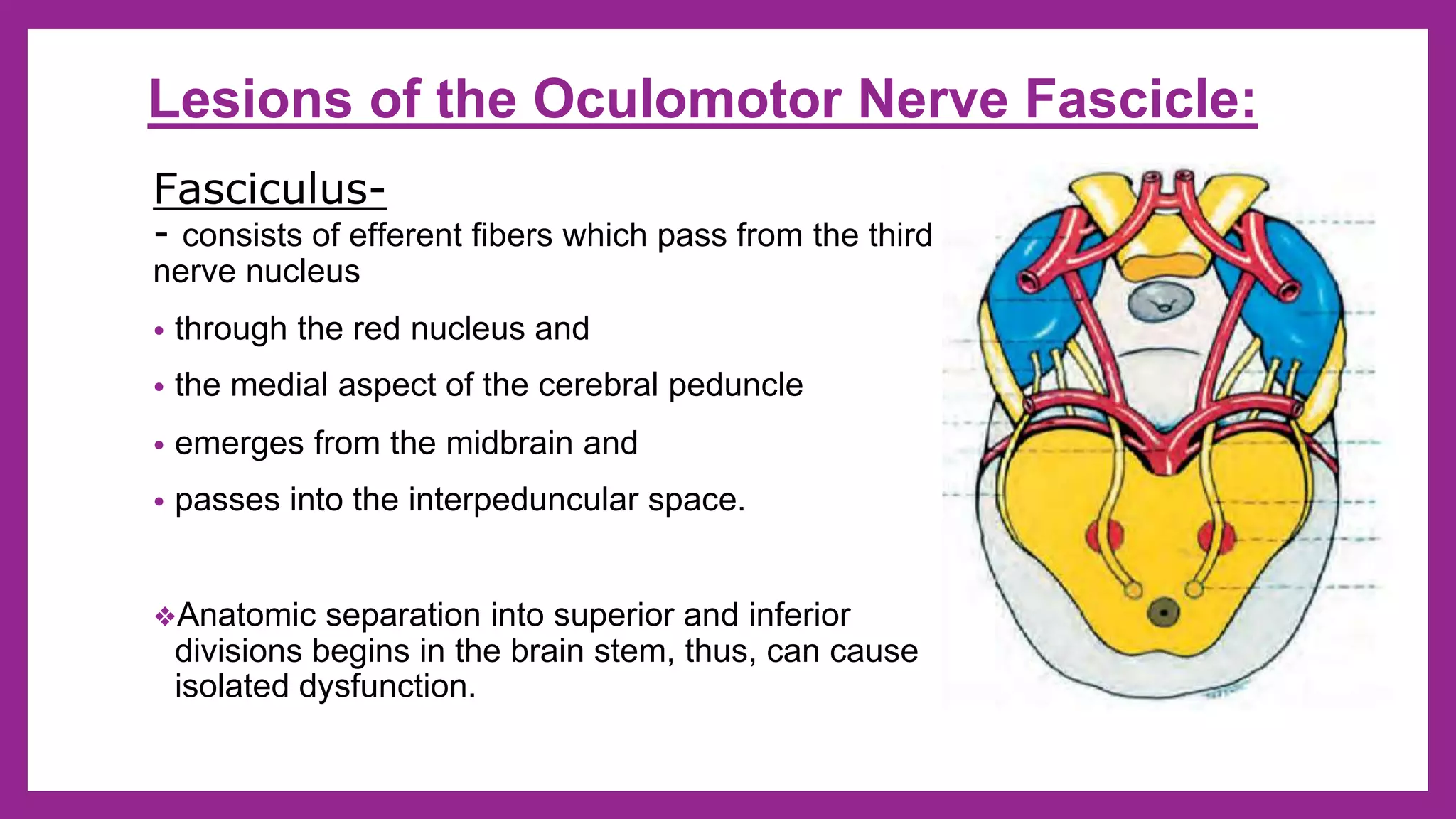 Ocular nerve palsy - 3rd, 4th and 6th cranial nerve palsy | PPTX