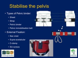 Pelvis by Dr Ben Parkinson | PPTX