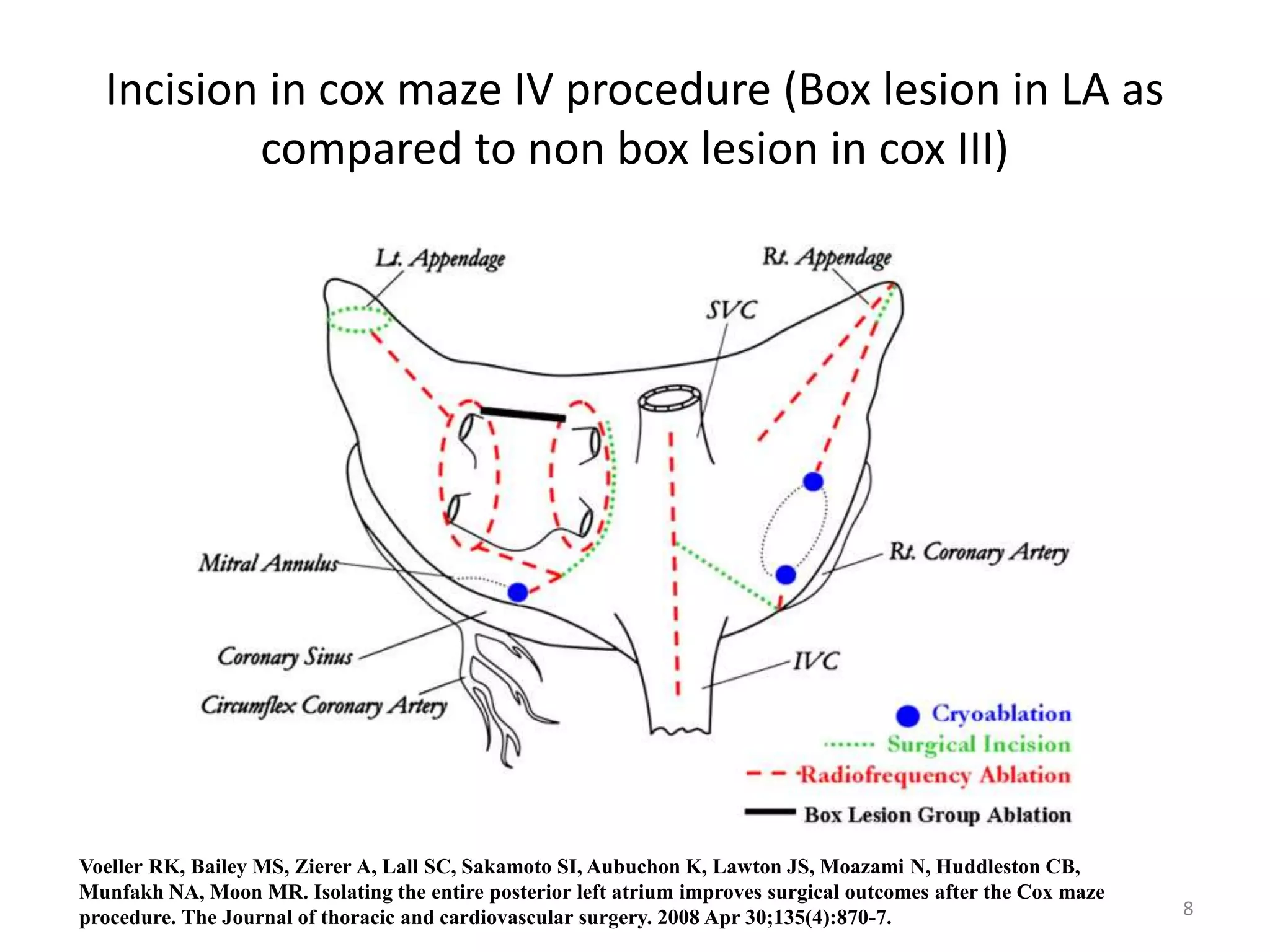 Hybrid atrial fibrillation ablation | PPTX