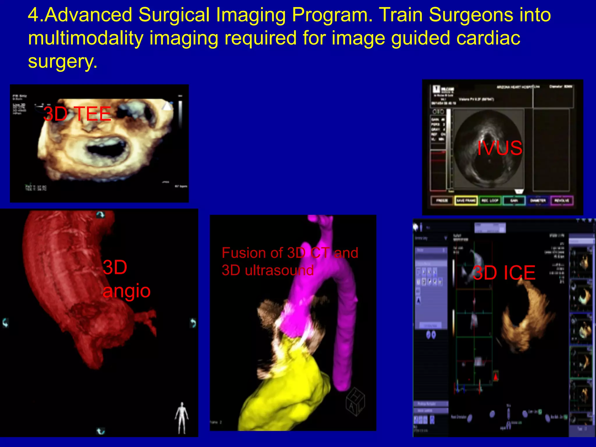 Hybrid cardiac surgery program | PDF
