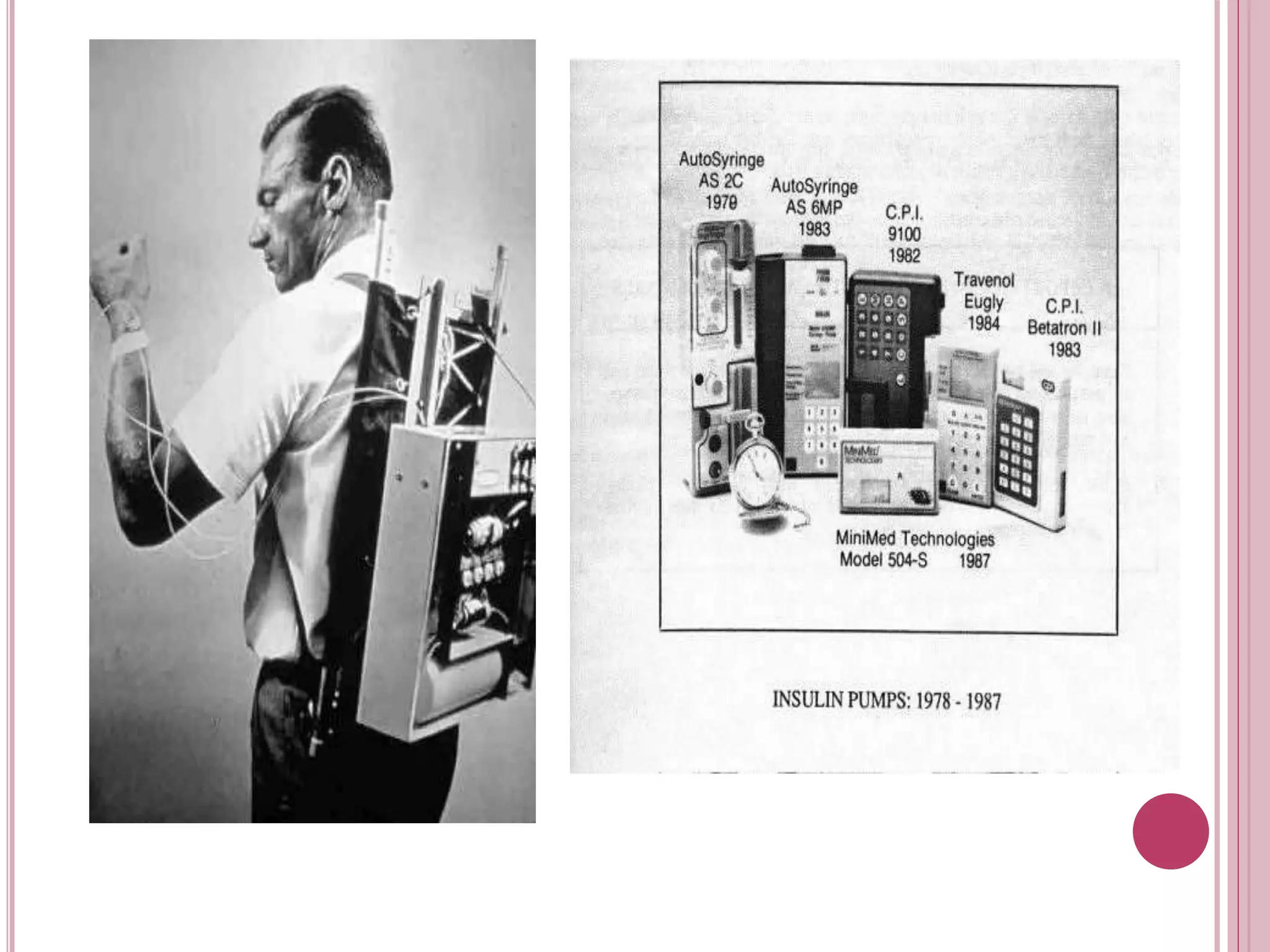 Hybrid closed loop insulin delivery system-Artificial Pancreas. | PPTX