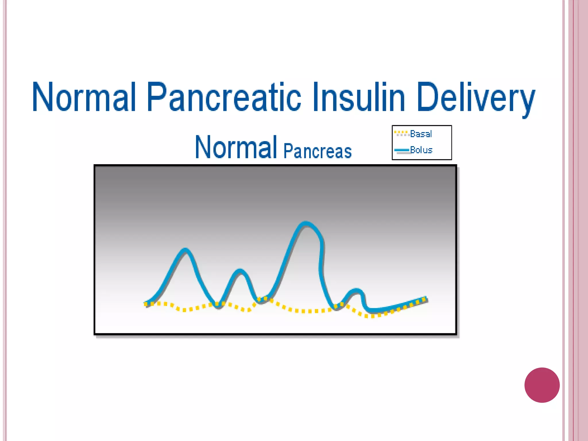 Hybrid closed loop insulin delivery system-Artificial Pancreas. | PPTX