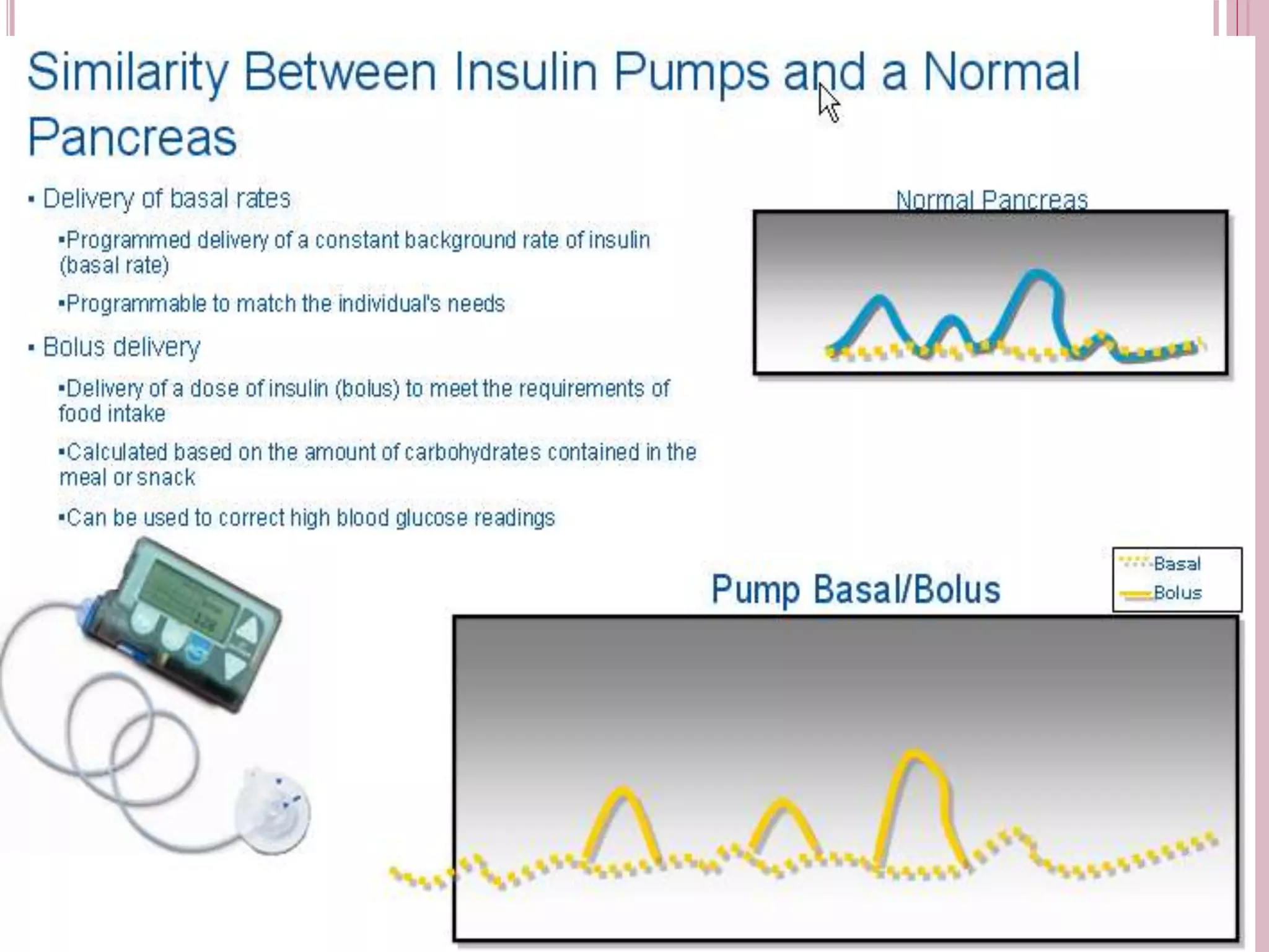 Hybrid closed loop insulin delivery system-Artificial Pancreas. | PPT