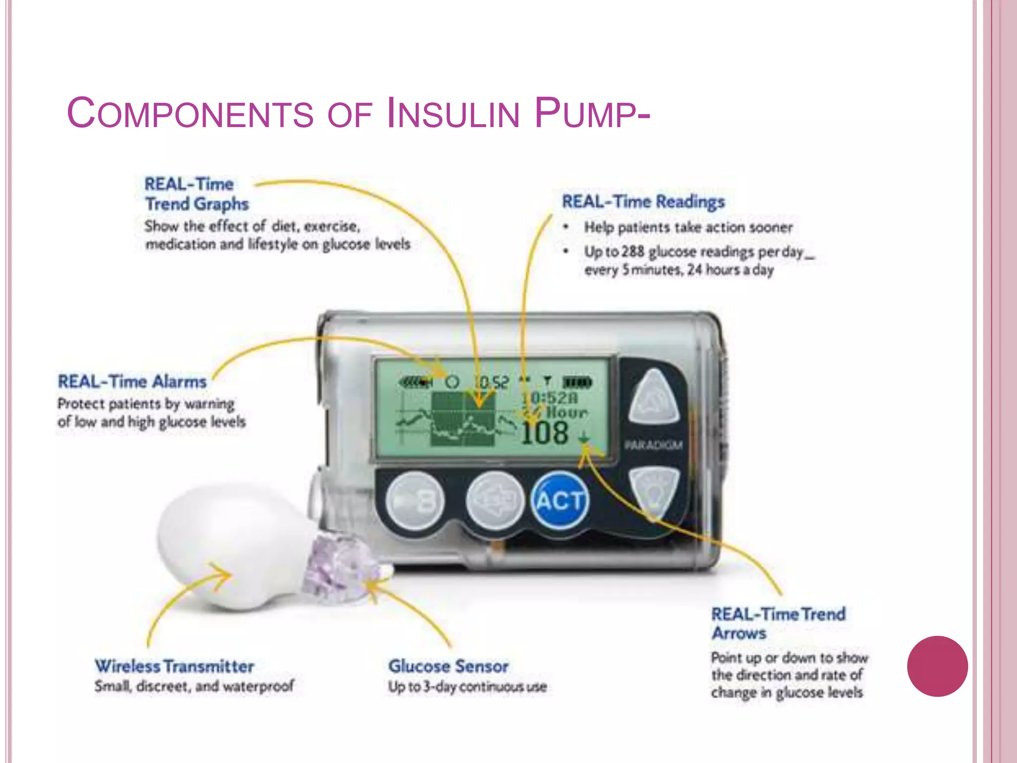 Hybrid closed loop insulin delivery system-Artificial Pancreas. | PPTX