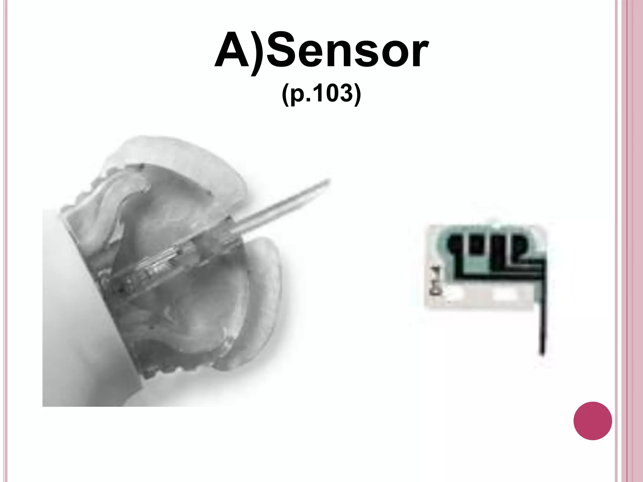 Hybrid closed loop insulin delivery system-Artificial Pancreas. | PPTX