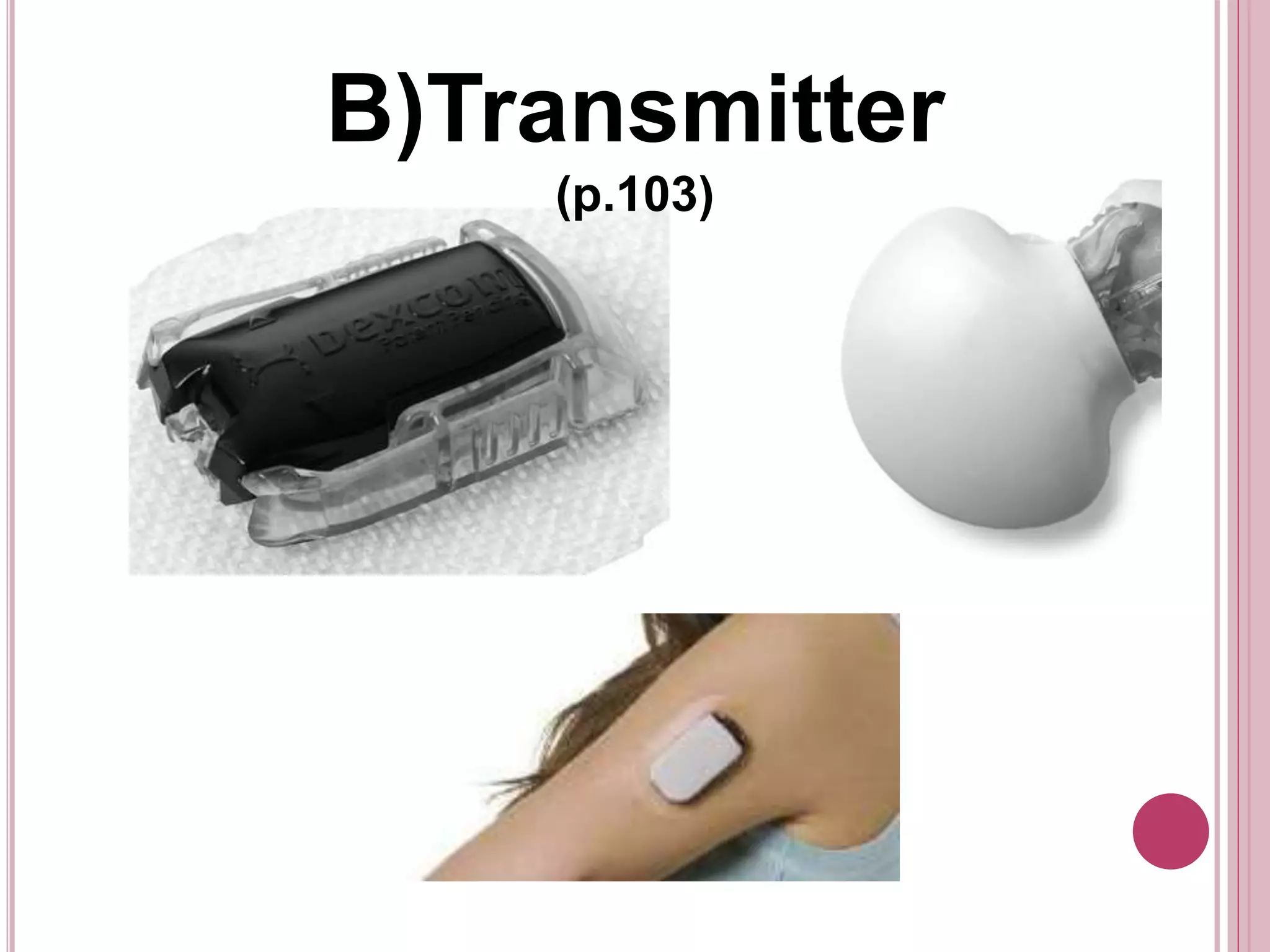 Hybrid closed loop insulin delivery system-Artificial Pancreas. | PPTX