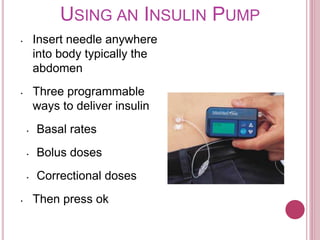 Hybrid closed loop insulin delivery system-Artificial Pancreas. | PPTX