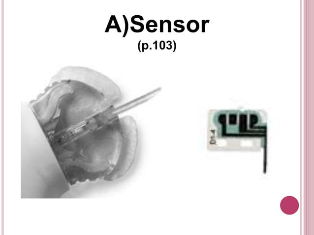 Hybrid closed loop insulin delivery system-Artificial Pancreas. | PPTX
