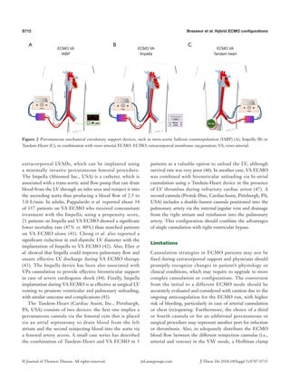Hybrid ecmo | PDF