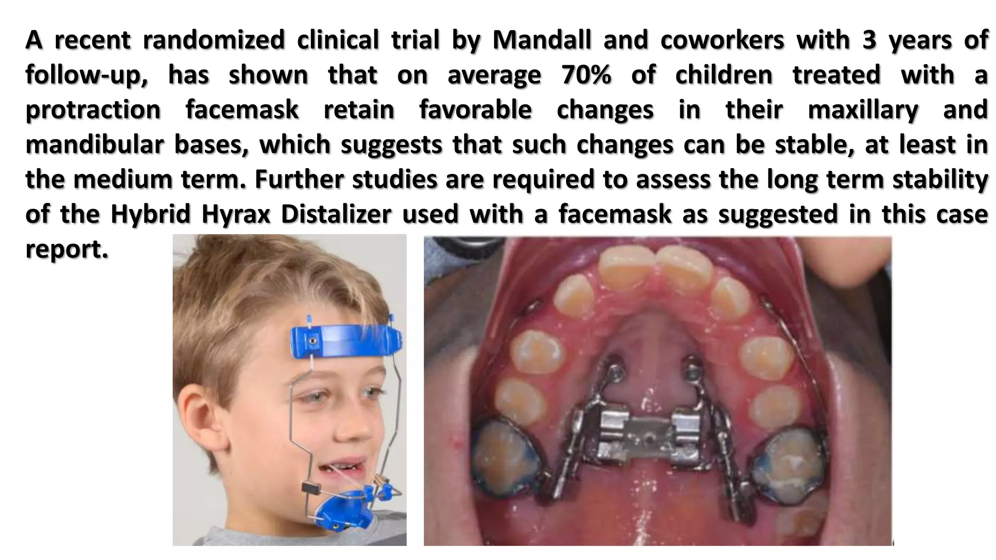 The Hybrid Hyrax Distalizer