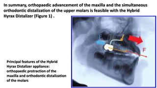 The Hybrid Hyrax Distalizer | PPTX