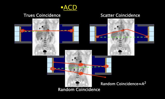 Hybrid imaging ashik sctimst | PPTX | Endocrine and Metabolic Diseases | Diseases and Conditions