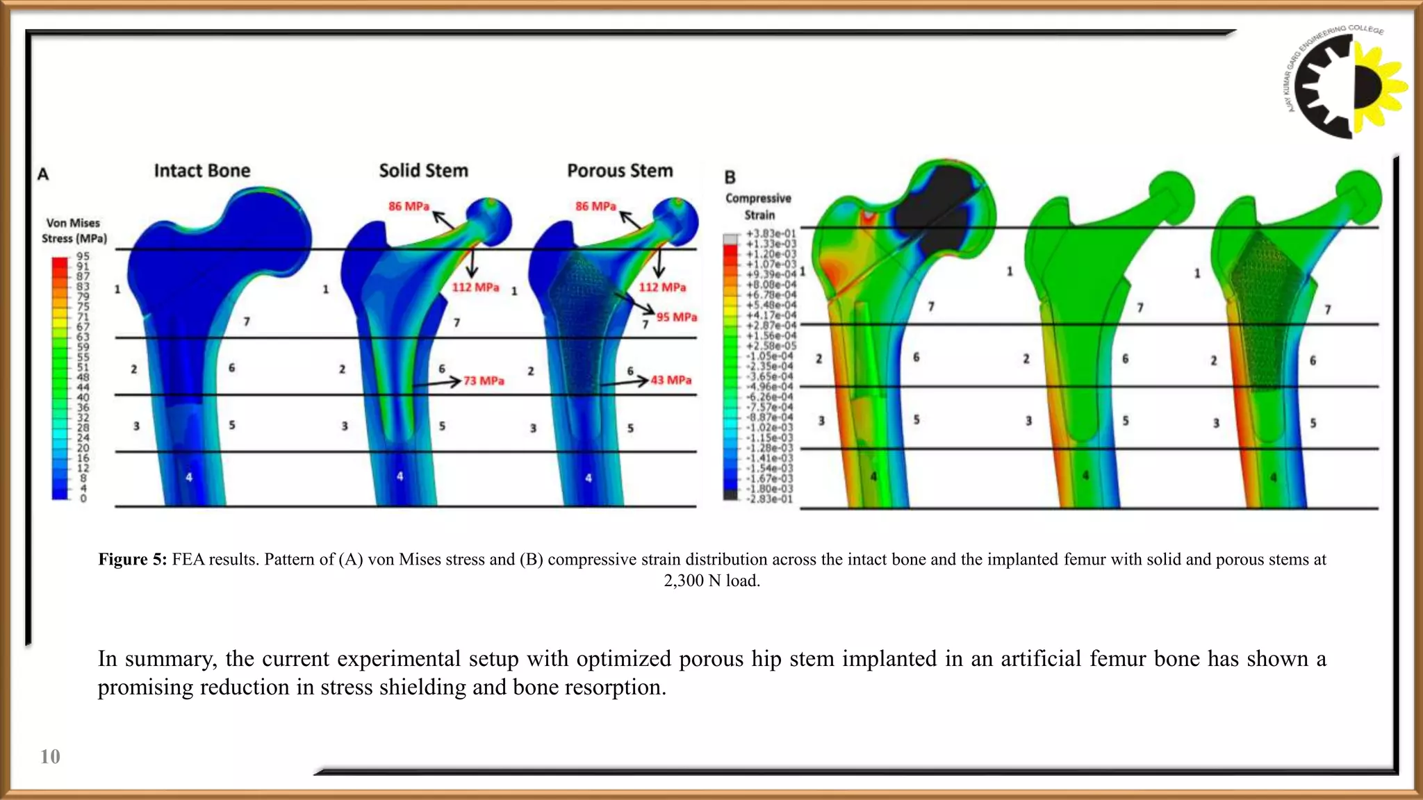 Hybrid Porous Hip Implant.pptx