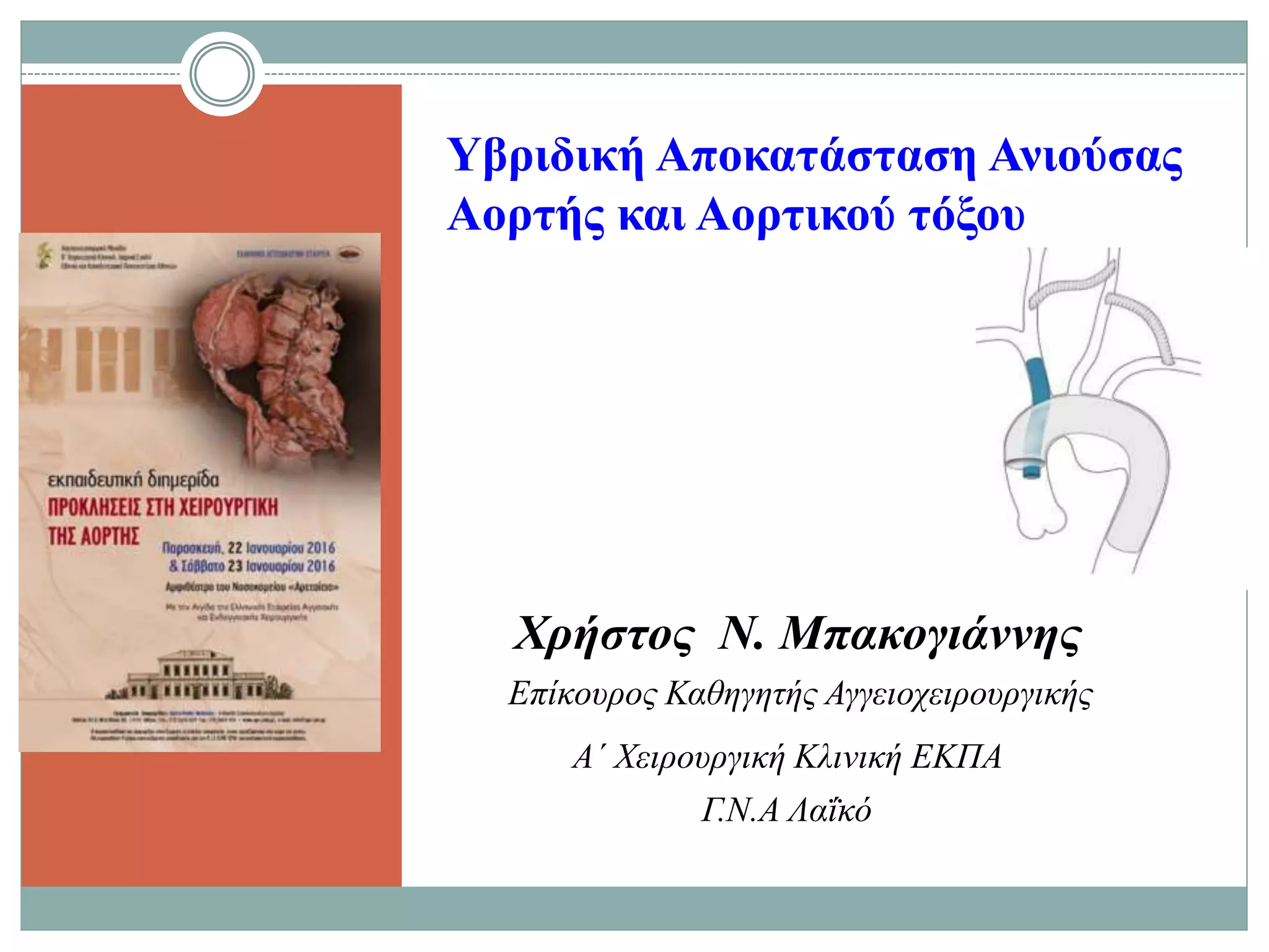 Υβριδική Αποκατάσταση Ανιούσας Αορτής και Αορτικού τόξου | PPT