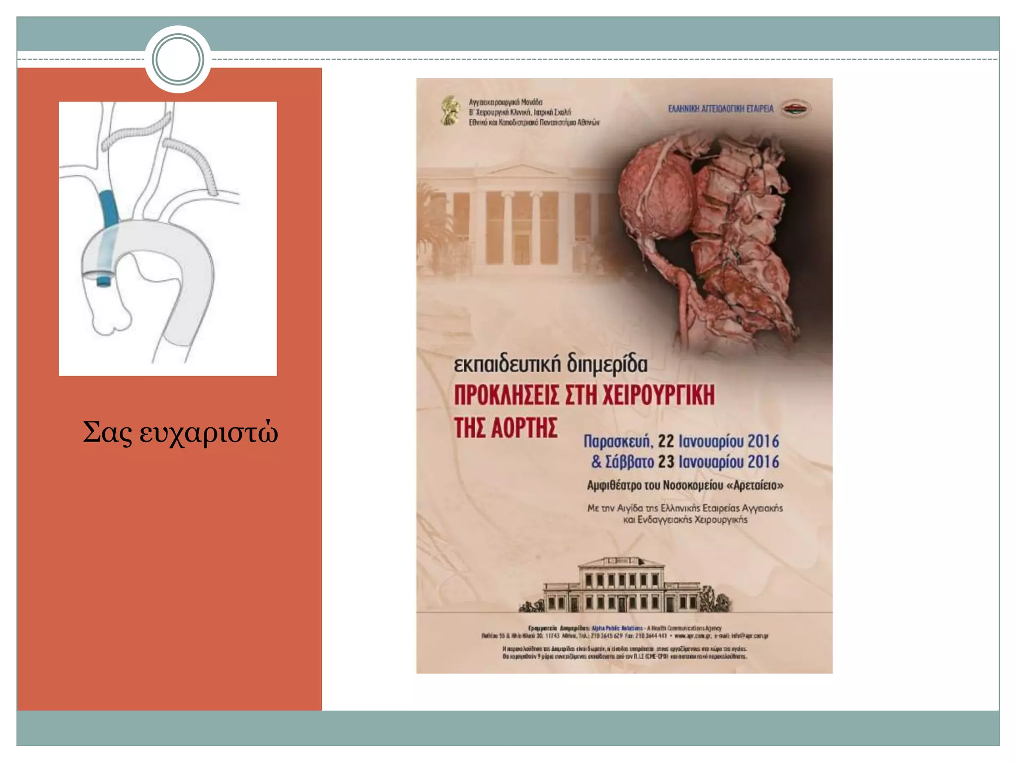Υβριδική Αποκατάσταση Ανιούσας Αορτής και Αορτικού τόξου | PPT | Free ...