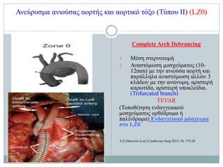 Υβριδική Αποκατάσταση Ανιούσας Αορτής και Αορτικού τόξου | PPT