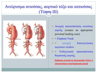Υβριδική Αποκατάσταση Ανιούσας Αορτής και Αορτικού τόξου | PPT