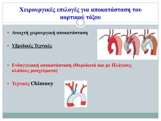 Υβριδική Αποκατάσταση Ανιούσας Αορτής και Αορτικού τόξου | PPT