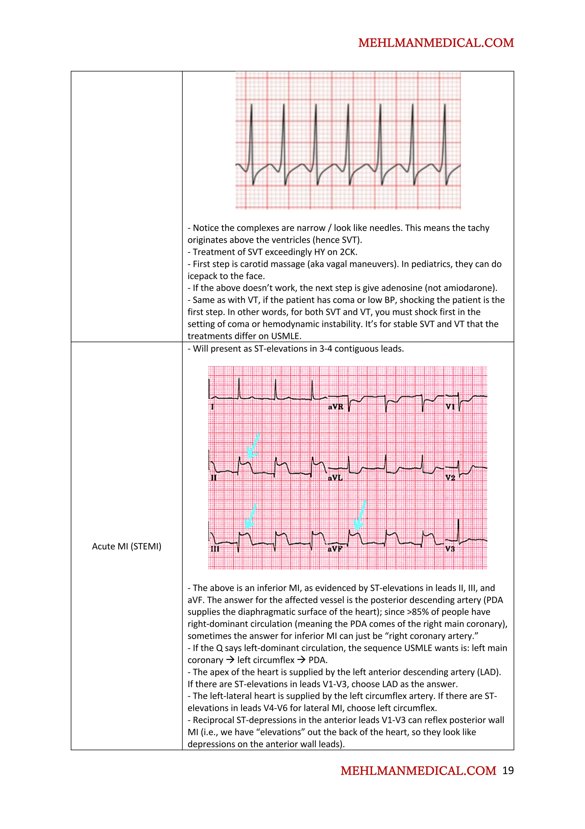 cardiac pathology usmle . High yield arrows by dr mike from Melman ...