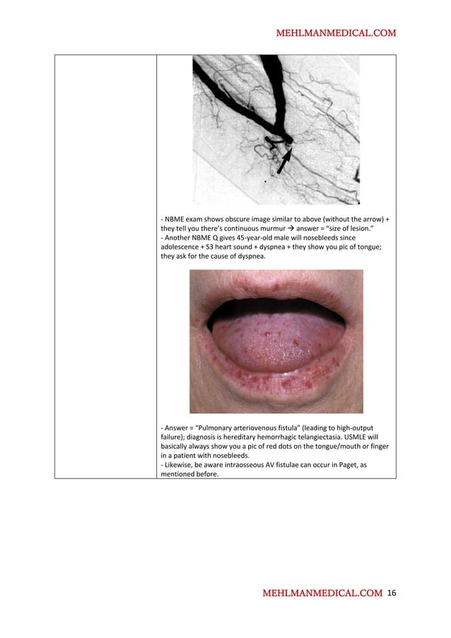 cardiac pathology usmle . High yield arrows by dr mike from Melman ...
