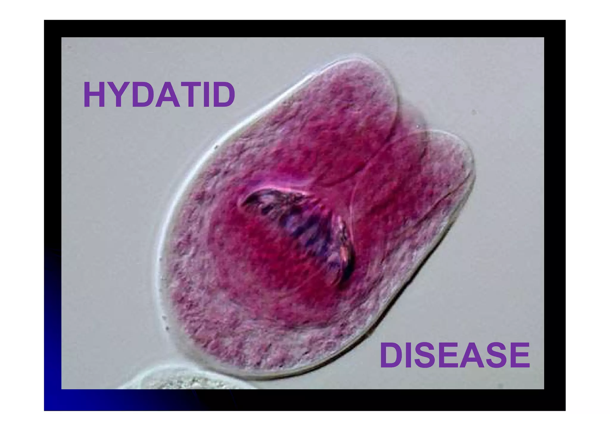 Hydatid Radiology | PDF | Lung and Respiratory Health | Diseases and ...
