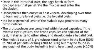 Hydatid cyst | PPTX