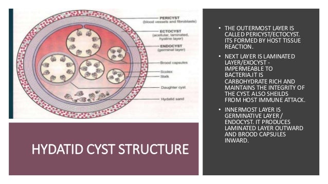 Hydatid cyst pulmonary